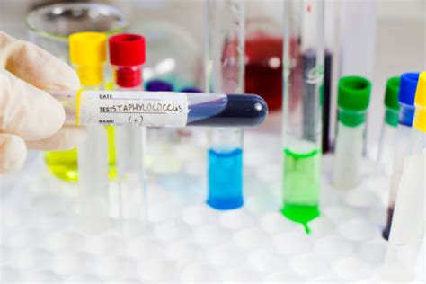 Stafilococul Auriu Ce Este și Cum Se Transmite