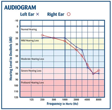 A Guide To Audiometric Testing Anitech Audiometric Testing Onsite Hearing Test Mobile