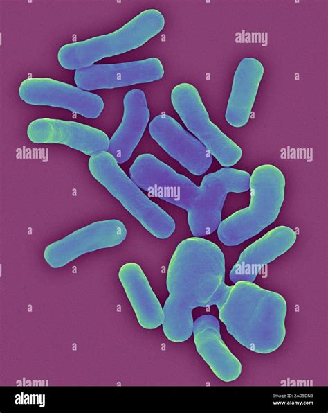 Coloured Scanning Electron Micrograph Sem Of Methylobacterium