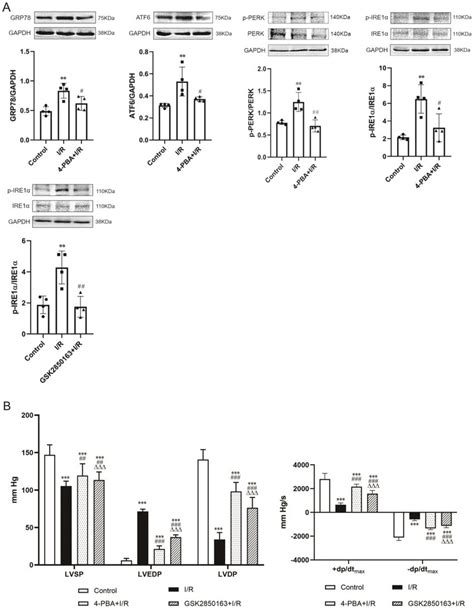 Activation Of The Ire1α Branch Of Er Stress Contributes To Global Download Scientific Diagram