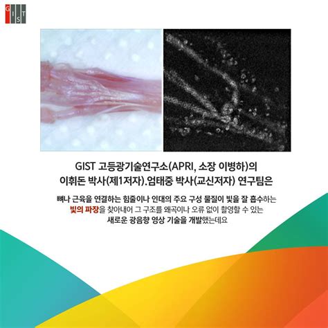 Gist 광주과학기술원 고등광기술연구소 이휘돈 ‧ 엄태중 박사 연구팀 힘줄만의 3차원 모습을 Facebook