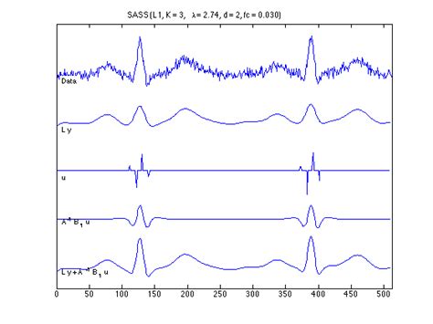 Example 2 Ecg Signal Denoising With The Sass Algorithm
