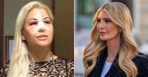 Woman Spends 60 000 On Plastic Surgery To Look Like Very Elegant