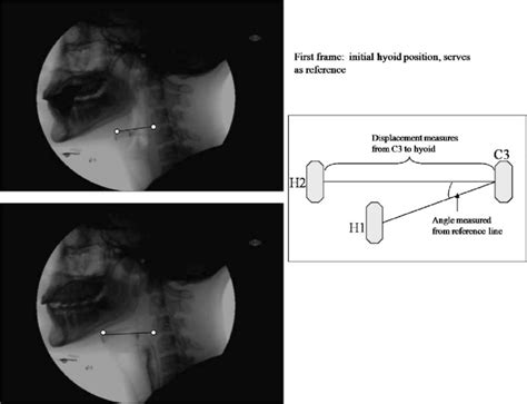 Example Of Measurements The MATLAB Routine Makes During Task Analysis Download Scientific