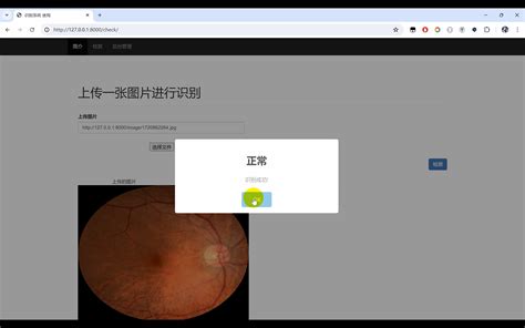 【眼疾识别】python深度学习人工智能算法模型训练tensorflowcnn卷积神经网络算法眼疾识别 Tensorflow Csdn博客