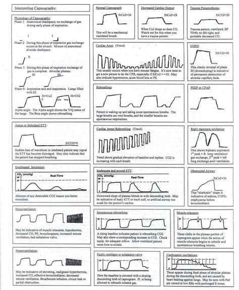 End Tidal Co2 Waveforms We Had A Big History Image Database