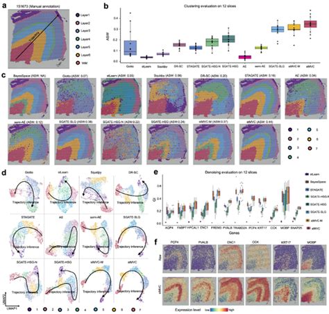 中科院团队开发了一种多视图图协作学习模型，可从空间分辨转录组学数据中阐明肿瘤异质性 知乎