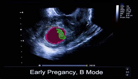 How Image Annotation Is Pushing Forward Object Detection Ai Keymakr
