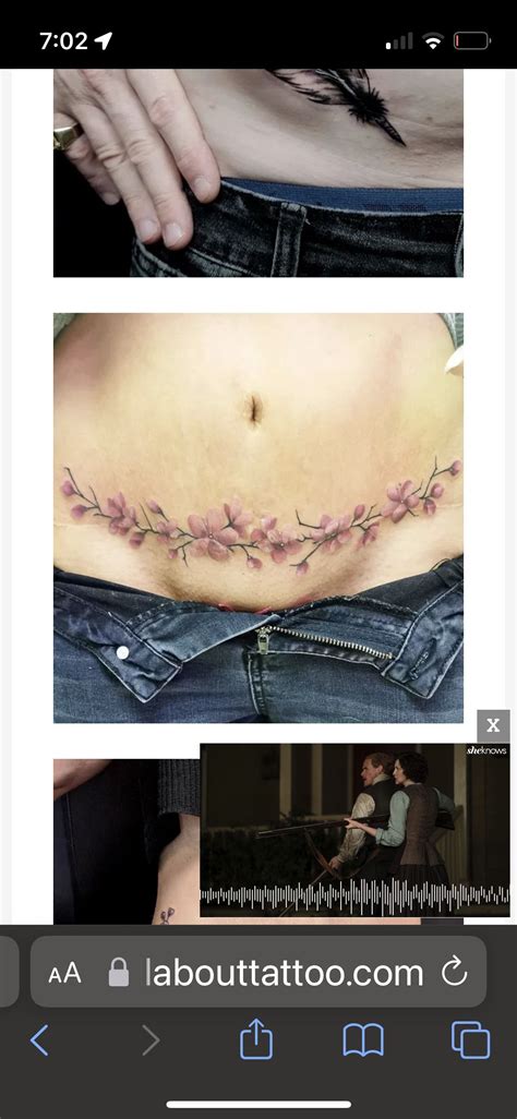 Pin By Jennifer Sanderford On Tattoo Scars Tattoo Cover Up Scar