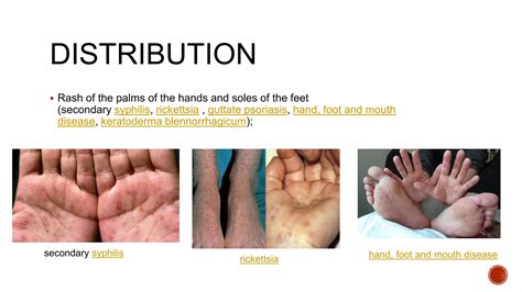 Approach To Skin Rash Pptx Approach To Skin Rash Pptx