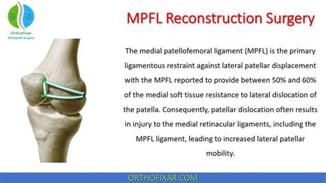 Mpfl Reconstruction Surgery Surgery Reconstruction Ligament Injury