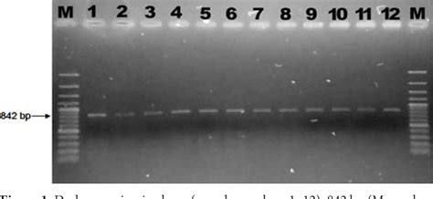 Figure 1 From Study Of Mitochondrial Dna Mtdna D Loop Region