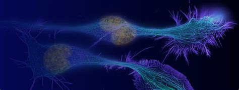 Hektoen Typhus Fever Is An Old Disease Long Confused With Typhoid