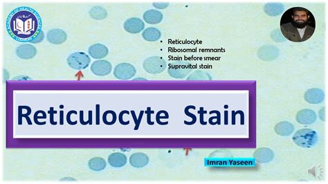 Reticulocyte Stain Supravital Stains Used For Reticulocytes