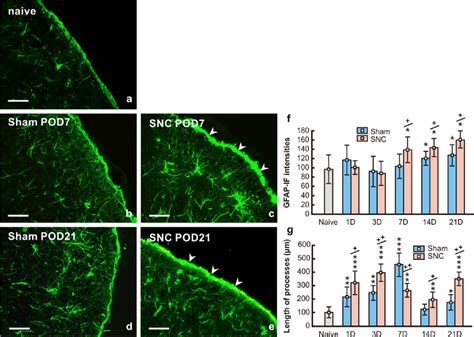 Representative Sections Of Mpfc From Naïve A Sham Operated B D Download Scientific