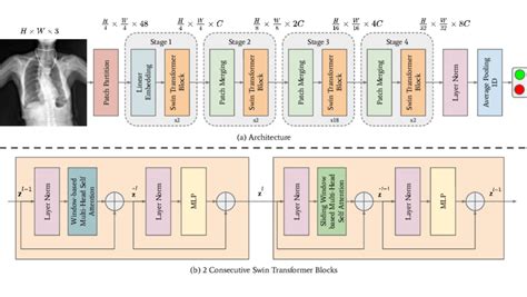 Swin Transformer Pipeline For Medical Image Quality Analysis