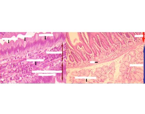 Villi And Crypts Of The Duodenum Quiz