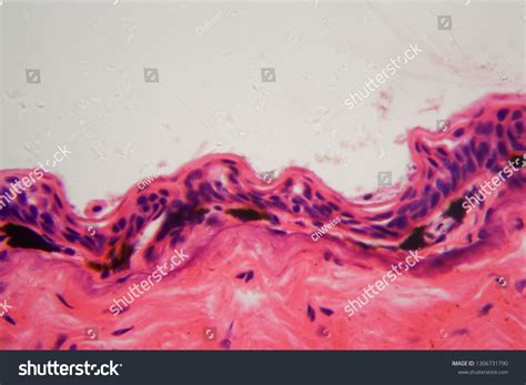 Cells Amphibian Skin Ulcer Under Microscope Stock Photo Shutterstock