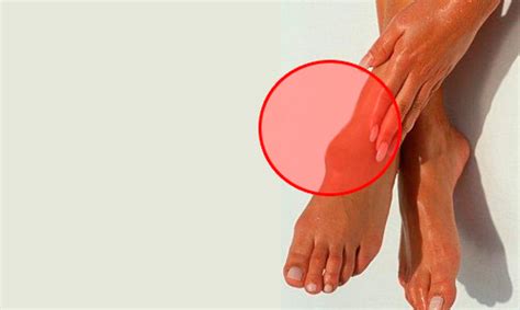 Уплотнение на ноге под кожей шишка на ноге фото и причины