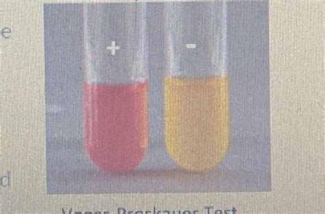 Quiz 2 Micro Lab Flashcards Quizlet