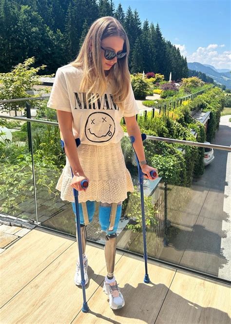 Pin By Tom Schneider On Anatomie Amputee Model Woman Disabled
