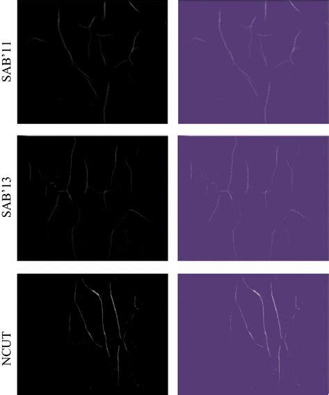 Anisotropic Diffusion Filtered Image Download Scientific Diagram