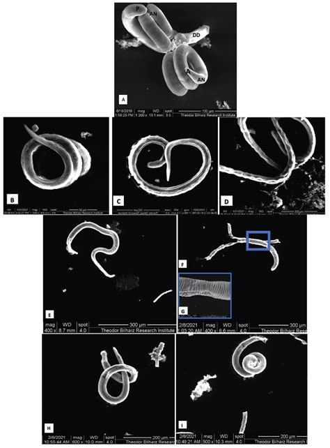 Trichinella Spiralis Morphology
