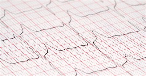 Hyperkalaemia Mind The Bleep