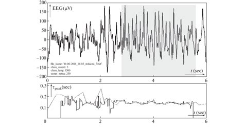 Temporal Dynamics Of The Position Of The Side Peak Bottom Of An EEG Download Scientific