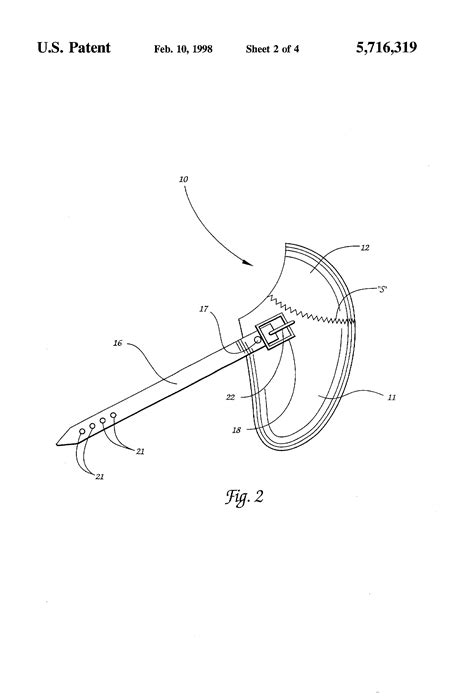Patent US5716319 Method Of Delaying Ejaculation During Sexual Intercourse Google Patents