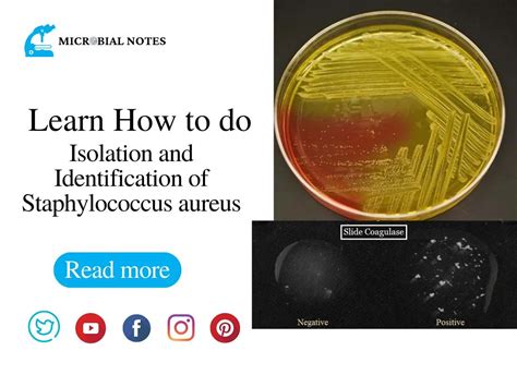 Isolation And Identification Of Staphylococcus Aureus Microbial Notes