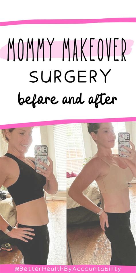 Mommy Makeover Surgery Before And After Mommy Makeover Mommy