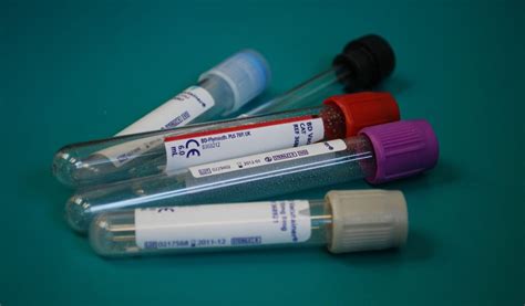 Should You Get An At Home Std Testing Kit The Exeter Daily