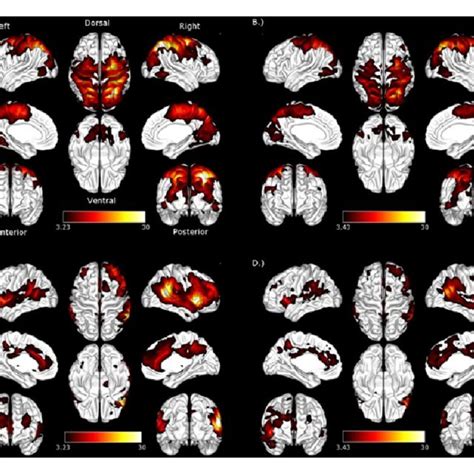Dorsal And Ventral Attention Networks Dorsal Attention Network In A Download Scientific