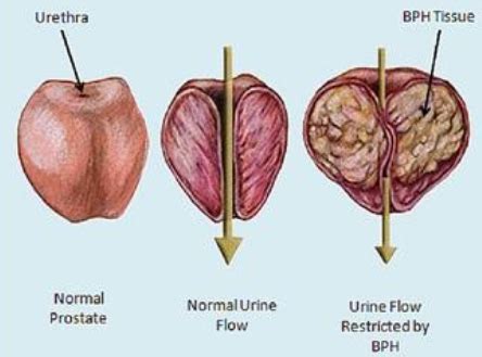 Exam Male Reproductive Disorders Flashcards Quizlet