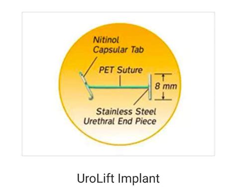 Urolift Aarna Superspeciality Hospital