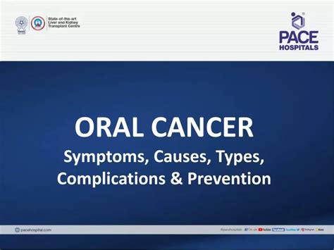 Ppt Oral Cancer Symptoms Causes Stages Risk Factors