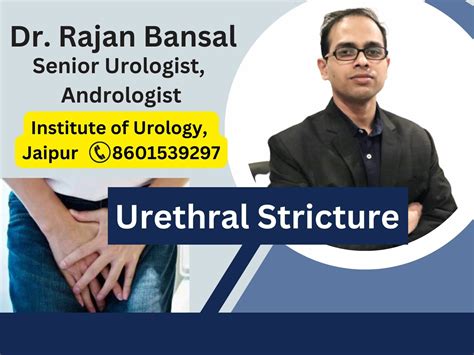 Urethral Stricture Causes Symptoms Diagnosis And Treatment