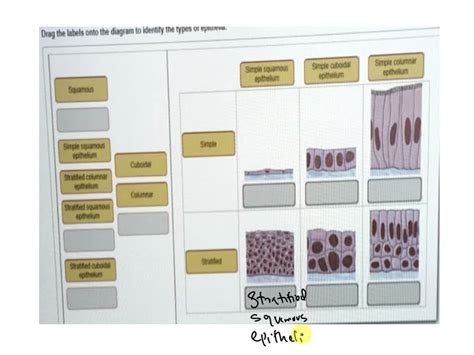 Solved Art Labeling Activity Classifying Epithelia Identify The Types