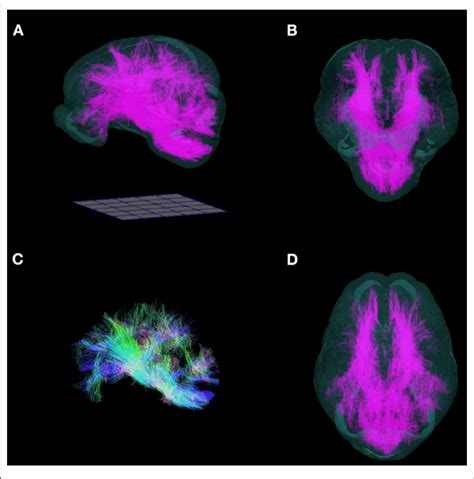 Three Dimensional Reconstruction Of Whole Brain Tractography In The