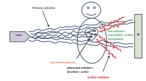 Unit X Ray Interactions Attenuation Flashcards Quizlet