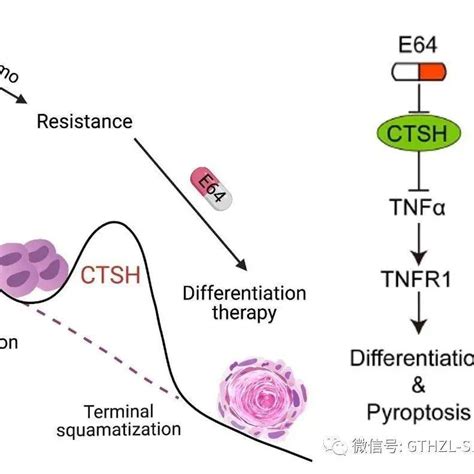 突破！川大陈崇教授团队发现肿瘤耐药新机制 化疗 治疗 Cancer