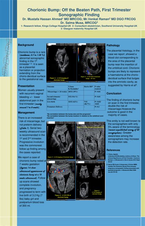 Pdf Chorionic Bump Off The Beaten Path First Trimester Sonographic Finding Mustafa Shazali