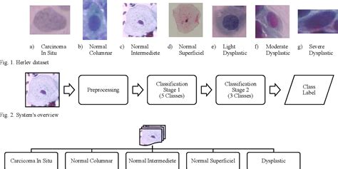 Figure 1 From Two Stage Classification Of Pap Smear Images Based On