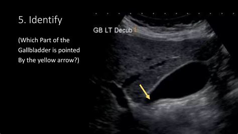 Radiology Practical Exam For Basic Pediatric And Git Imaging Pptx