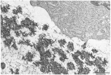 Electron Micrograph Of A 6 D Old Growth Plate Chondrocyte Culture It
