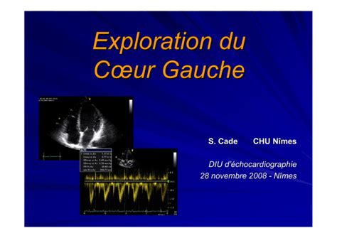 Segmentation Cardiaque