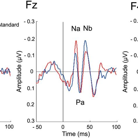 Middle Latency Responses At The F3 Fz And F4 Electrodes Mlr