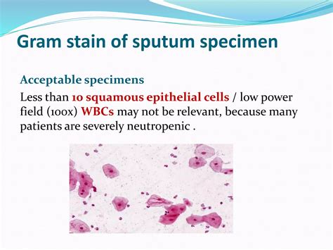 Sputum Sample Processing Pptx