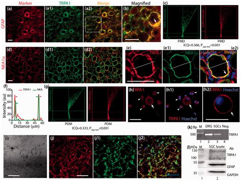 Satellite Glial Cells